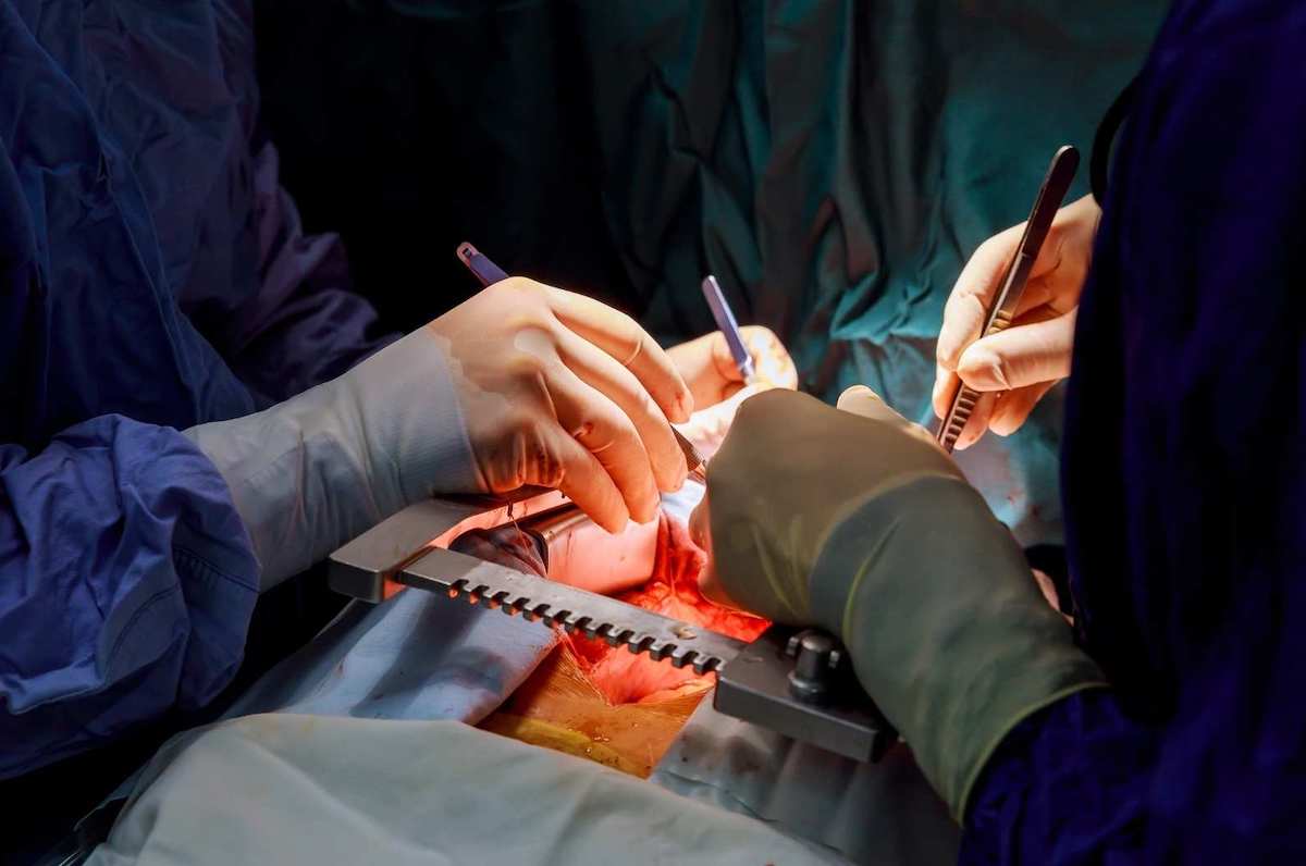 Why Surgeons Mark Inside Patients' Bodies | Yasui Co., Ltd.