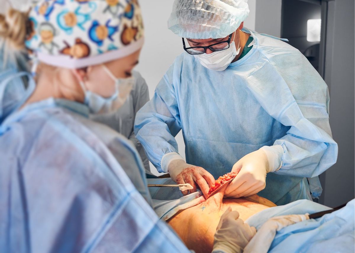 Retractors Used in Body Contour Surgery | Yasui Co., Ltd.