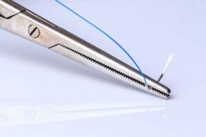 Skin and Body Tissue Marking Methods for Surgery | Yasui Co., Ltd.